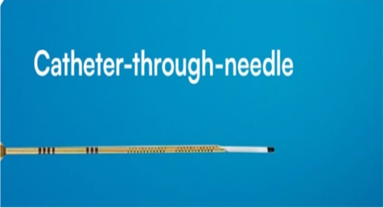 EP147 Review article: ‘comparative analysis of catheter-over-needle vs ...
