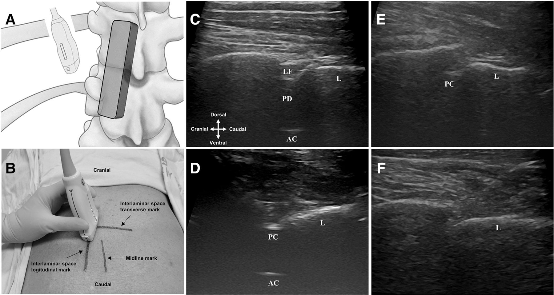 Comparison of sitting and prone positions for real-time ultrasound ...