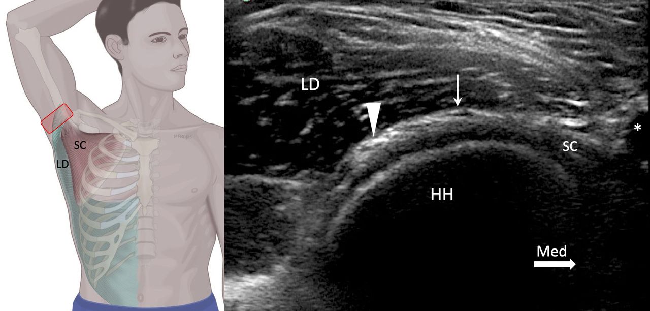 Axillary nerve: what anesthesiologists and pain physicians should know ...